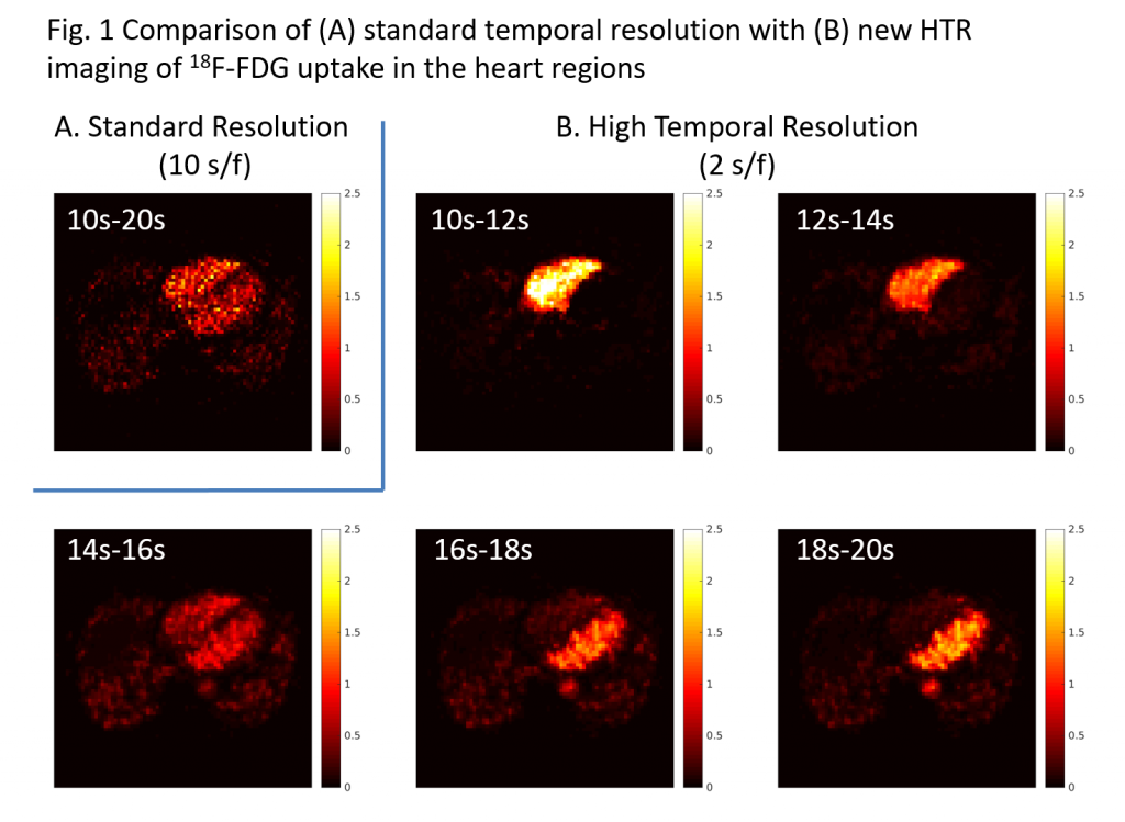 High-temporal Resolution (HTR) Parametric PET: New Kinetic Modeling ...