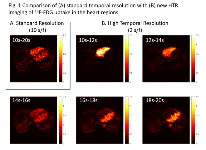 High-temporal Resolution (HTR) Parametric PET: New Kinetic Modeling ...
