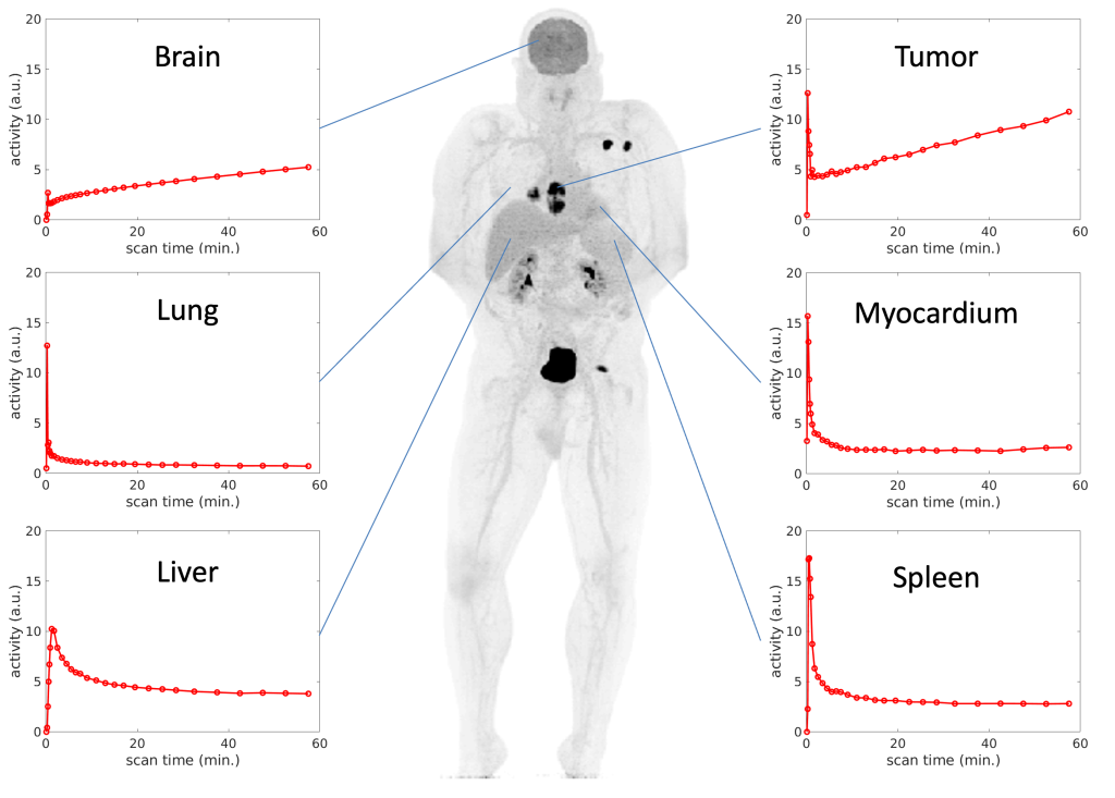 Research – Wang Lab – PET Parametric Imaging